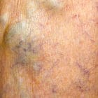 Chicago, IL - Oak/Elmwood Park - VitalSkin Dermatology