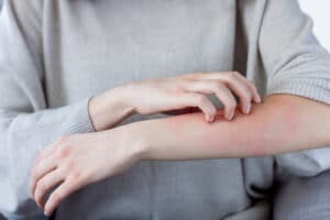 Can Clothing Fabric Cause Dermatitis? | VitalSkin Dermatology