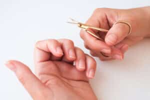 How to Get Rid Of and Prevent Hangnails - VitalSkin Dermatology